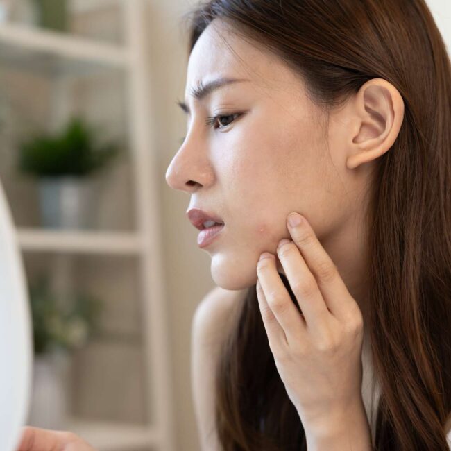 Enlarged Pores & Skin Texture